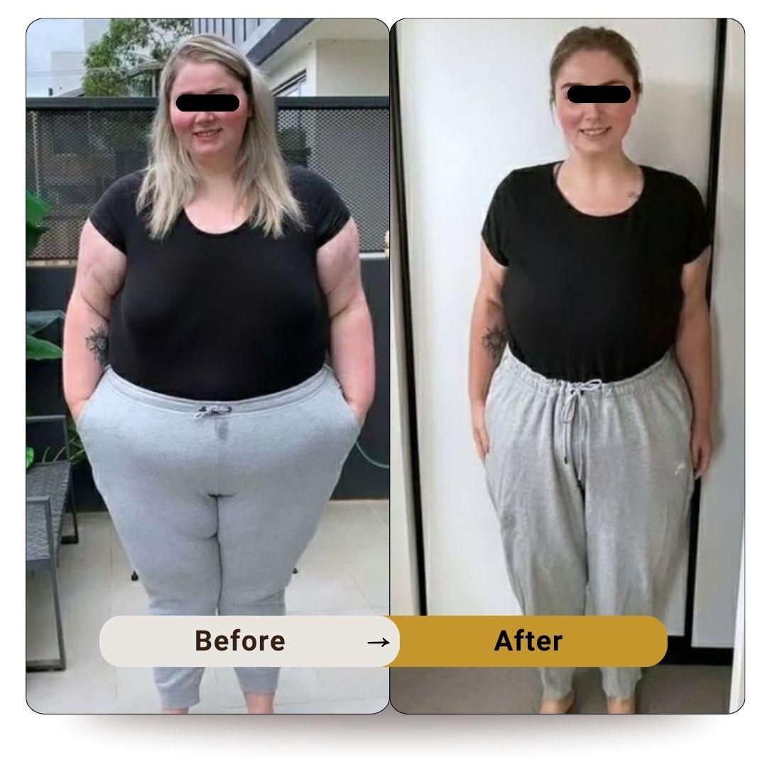 Clinical Weight Loss Solutions & Skin Clinic Dubai | Elite Body Home