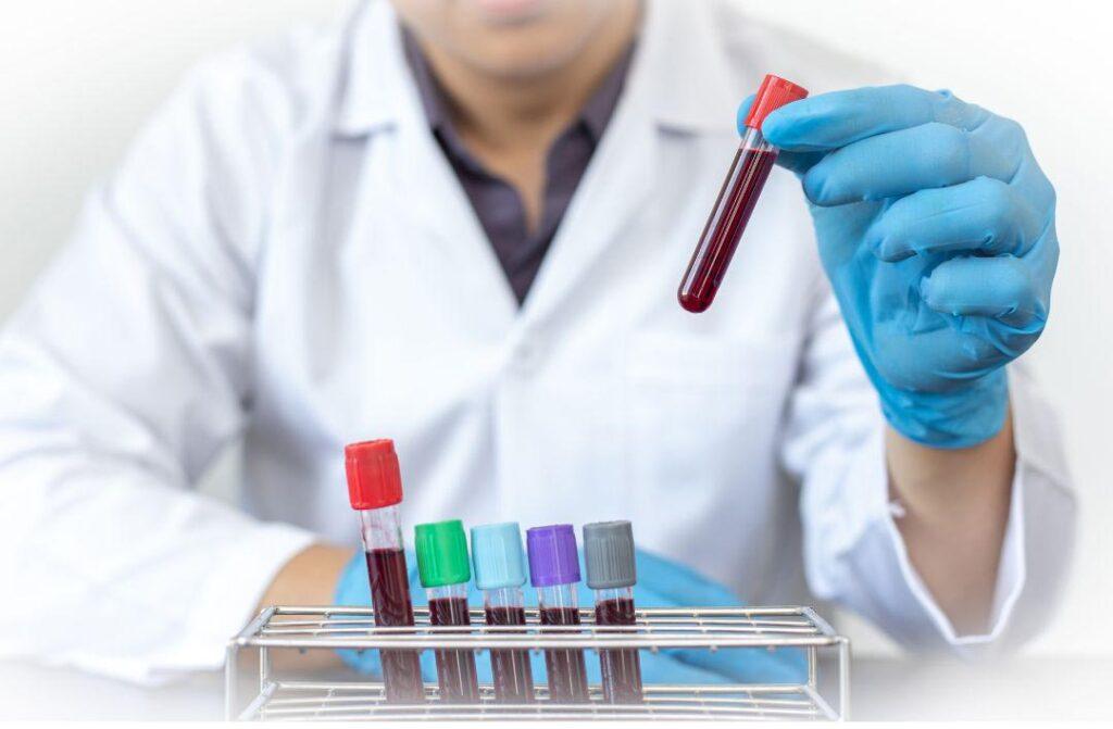 Blood Test at Home in Dubai | Elite Body Home Polyclinic