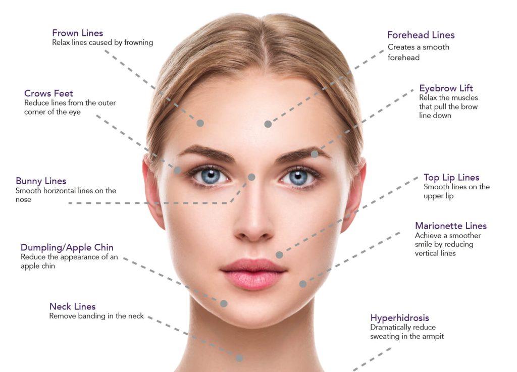 Full Face Botox Injection & Treatments in Dubai