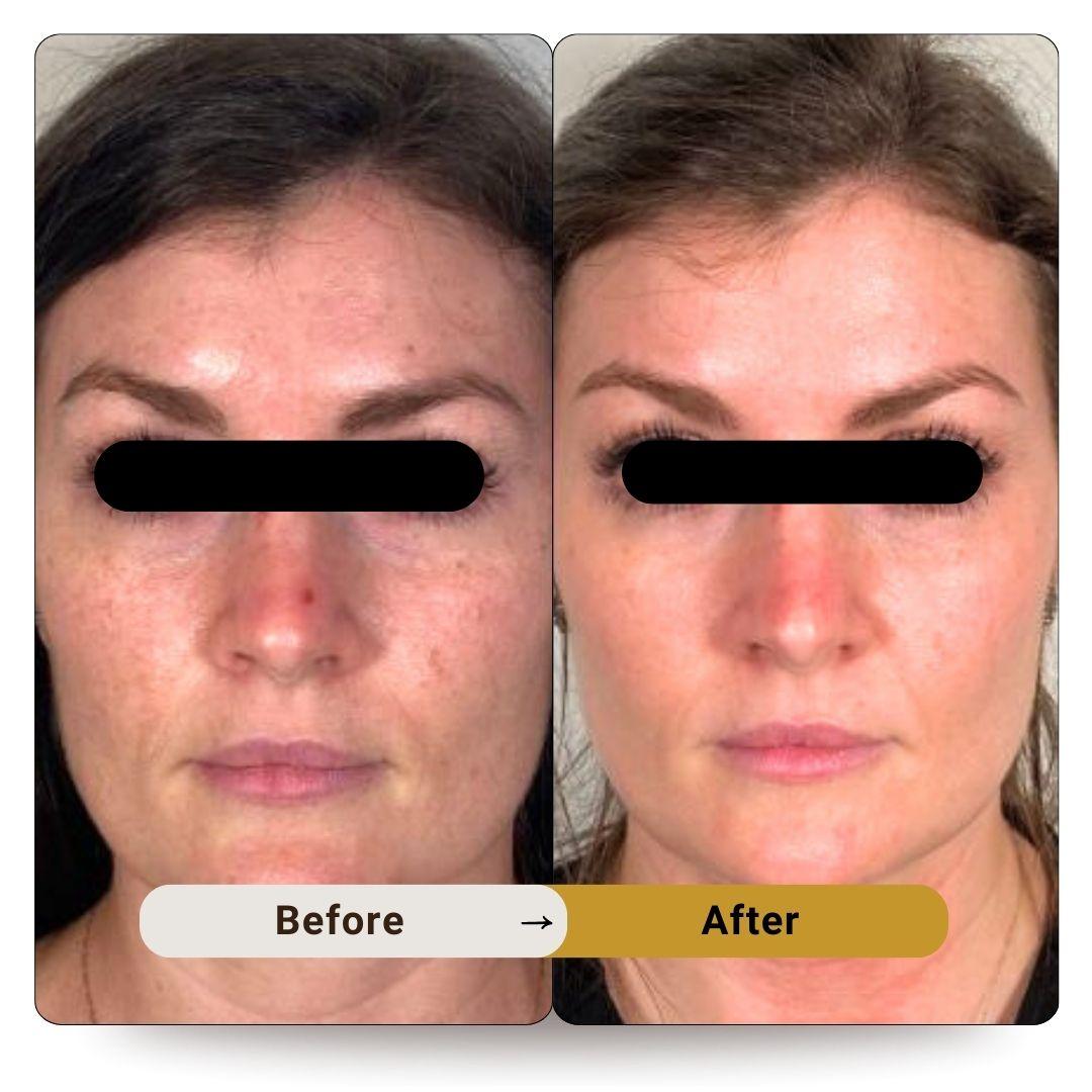 Clinical Weight Loss Solutions & Skin Clinic Dubai | Elite Body Home