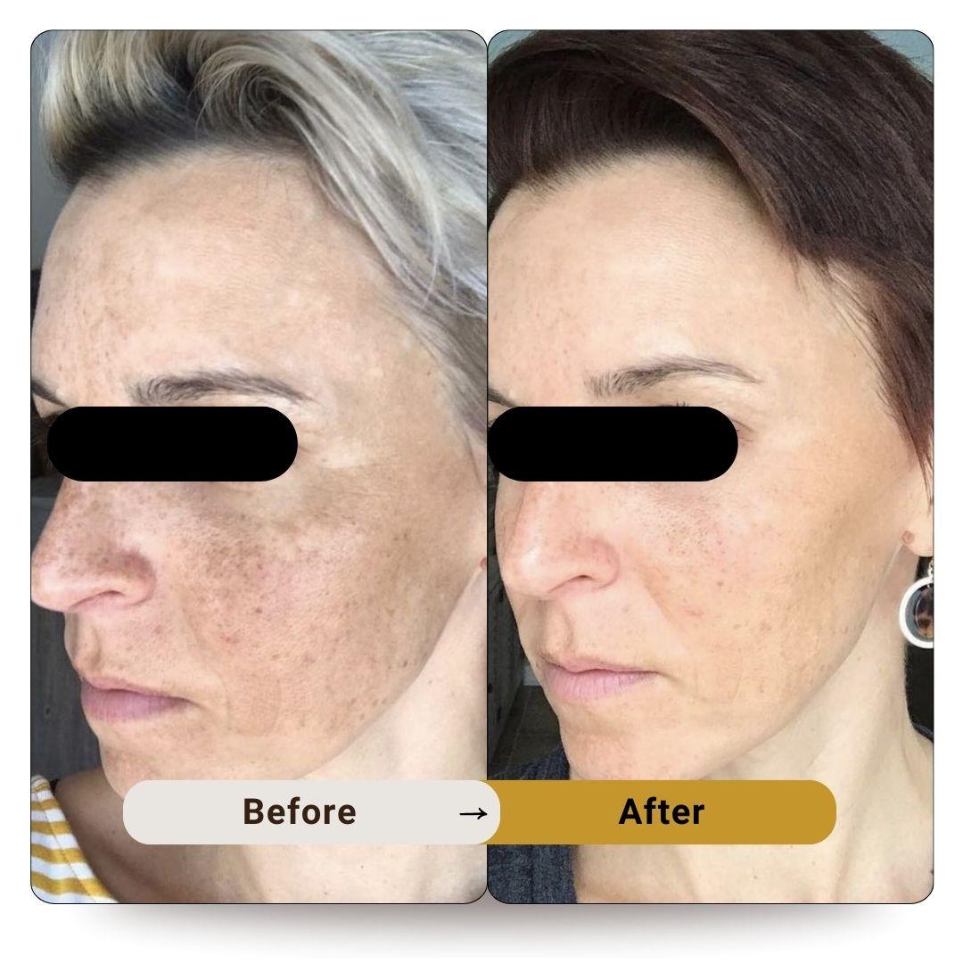 Clinical Weight Loss Solutions & Skin Clinic Dubai | Elite Body Home